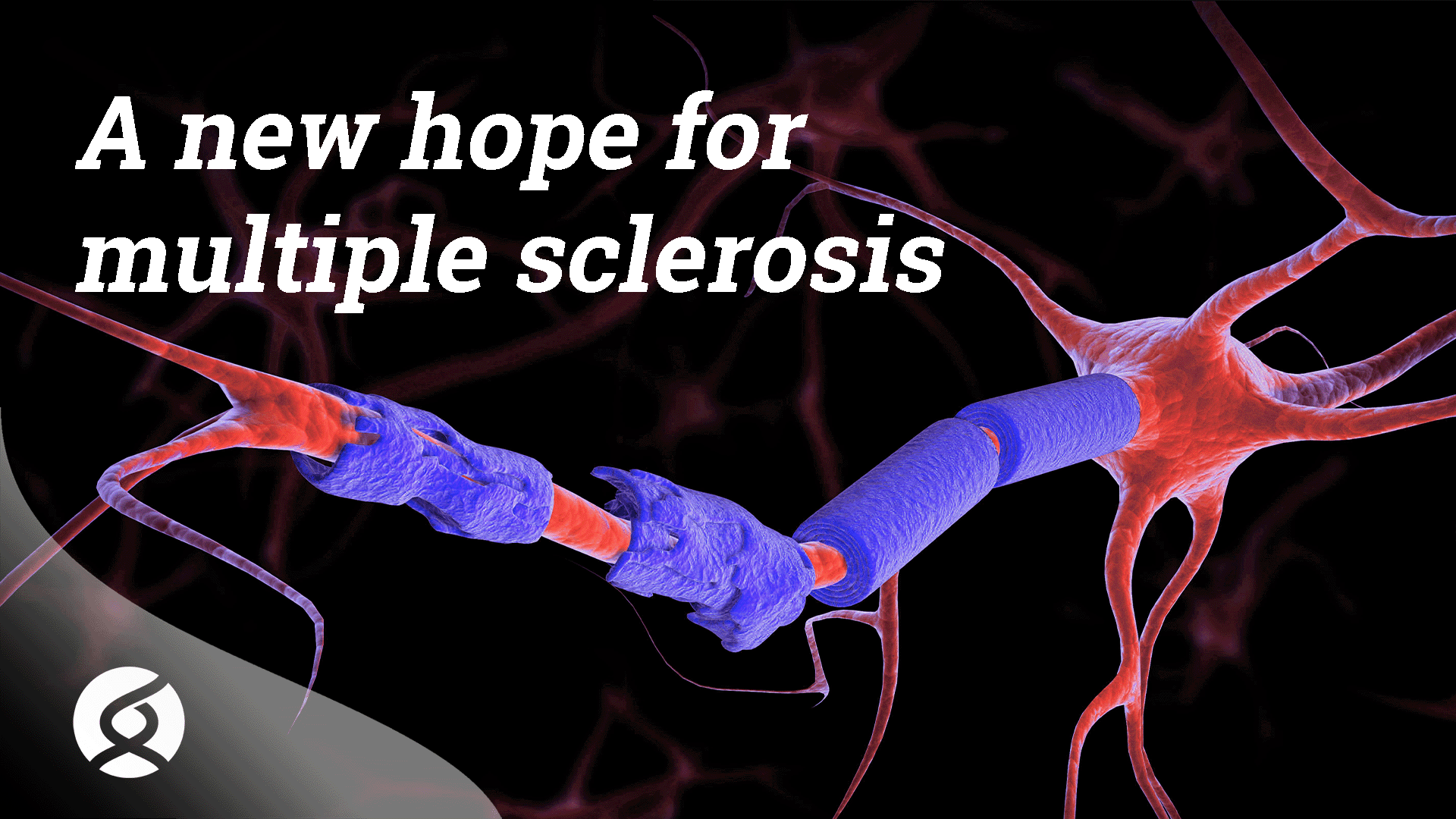 Multiple Sclerosis New Discoveries Related To Gut Microbiota And
