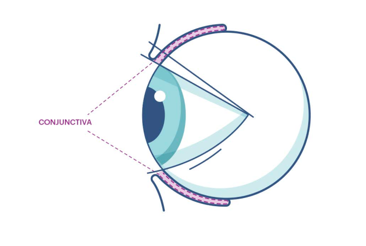 Learn the Basics of Eye Care | ACUVUE® Contact Lenses | Acuvue