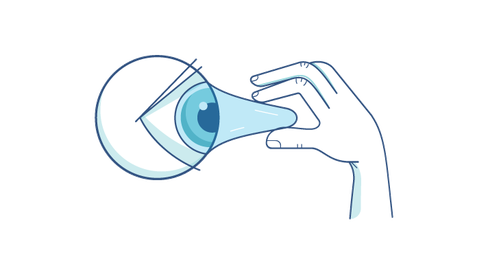 ACUVUE® LensAssist®