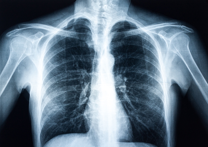 High-Energy Radiography | ASTM