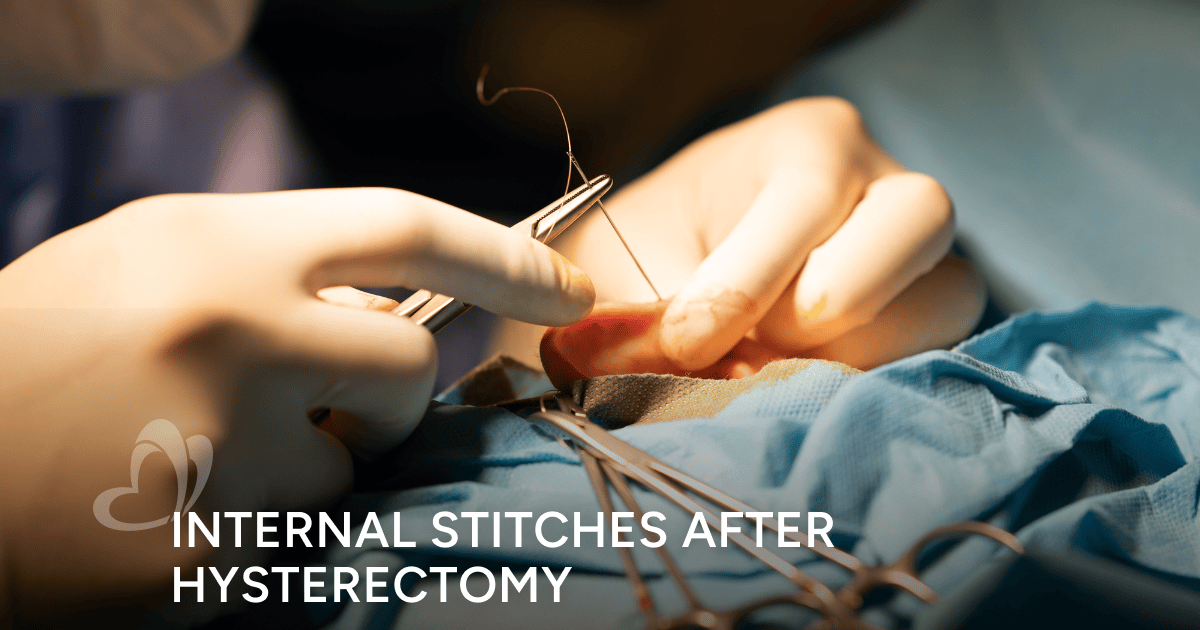 Internal Stitches After Hysterectomy: What To Expect | Thomson Medical