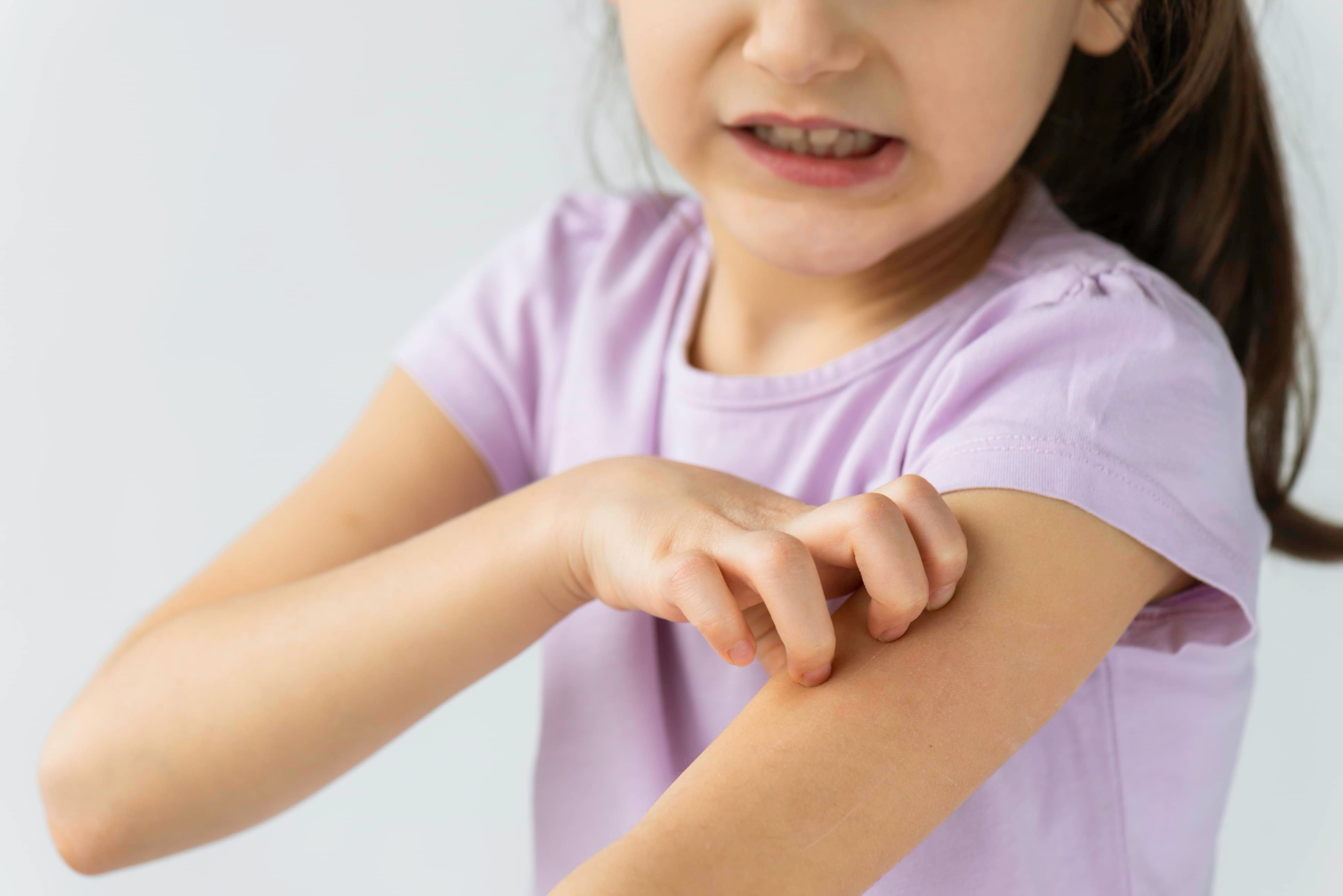 Paediatric Dermatology | Thomson Medical