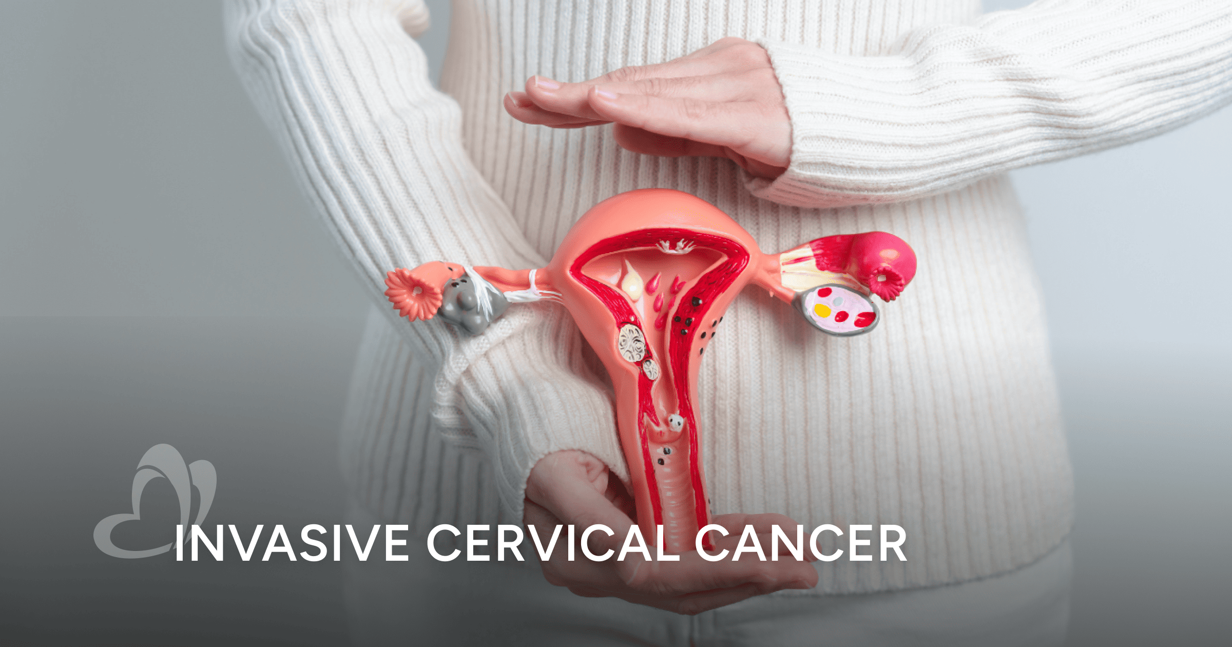 Invasive Cervical Cancer: Causes, Symptoms, and Treatment | Thomson Medical