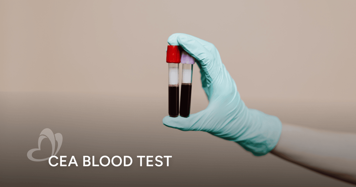 CEA Blood Test in Singapore: It's Importance and Purpose | Thomson Medical