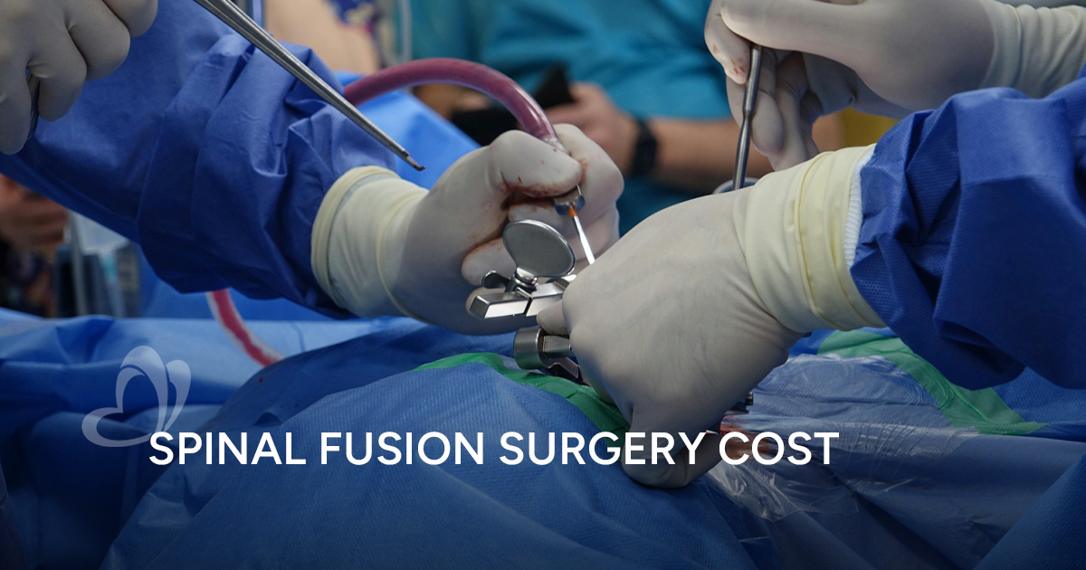 Spinal Fusion Surgery Costs at Private Hospitals in Singapore: What to ...