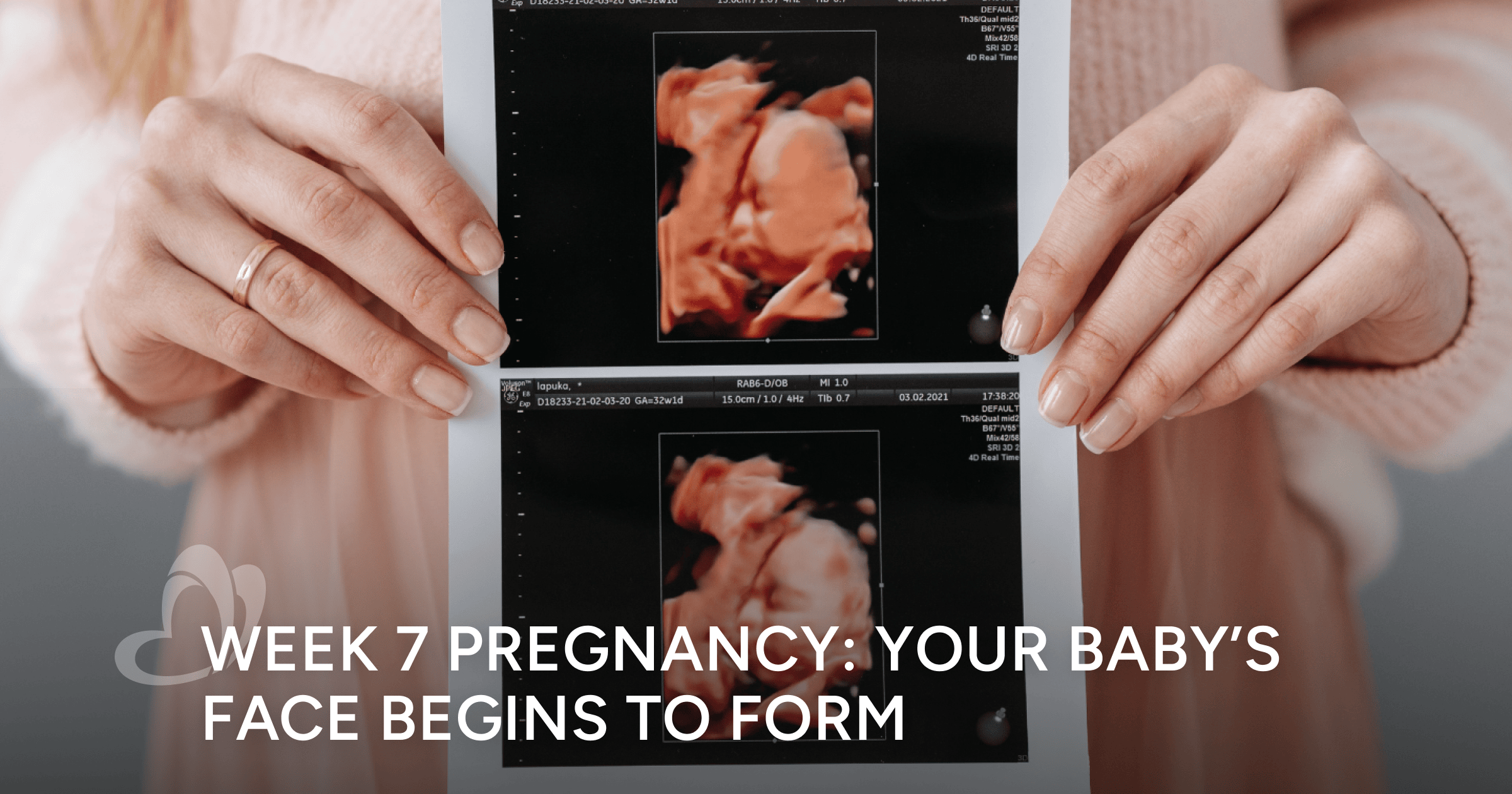 Week 7 Pregnancy: Your Baby’s Face Begins to Form | Thomson Medical
