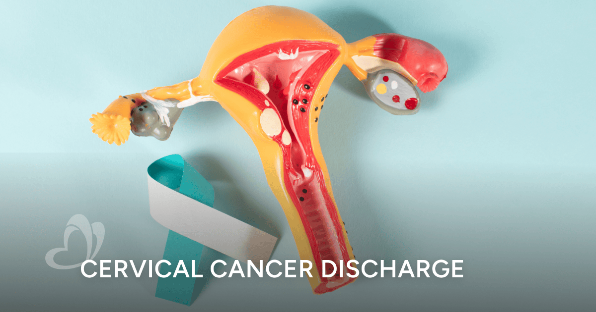 Cervical Cancer Discharge: What It Means and When to See a Doctor ...