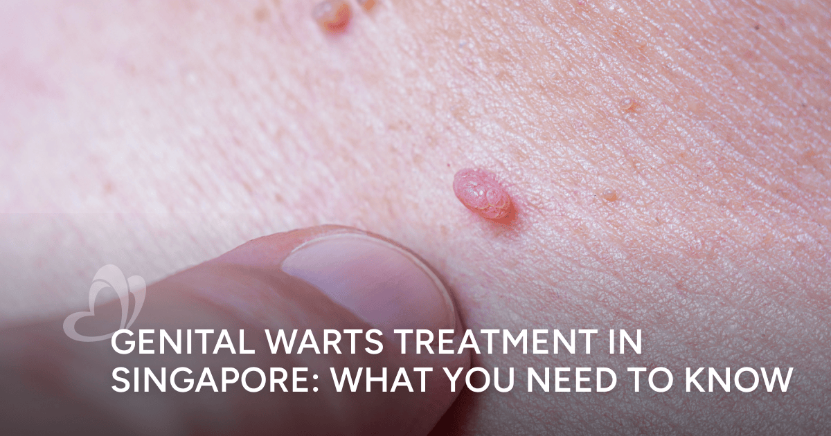 Genital Warts Treatment in Singapore: What You Need to Know | Thomson ...