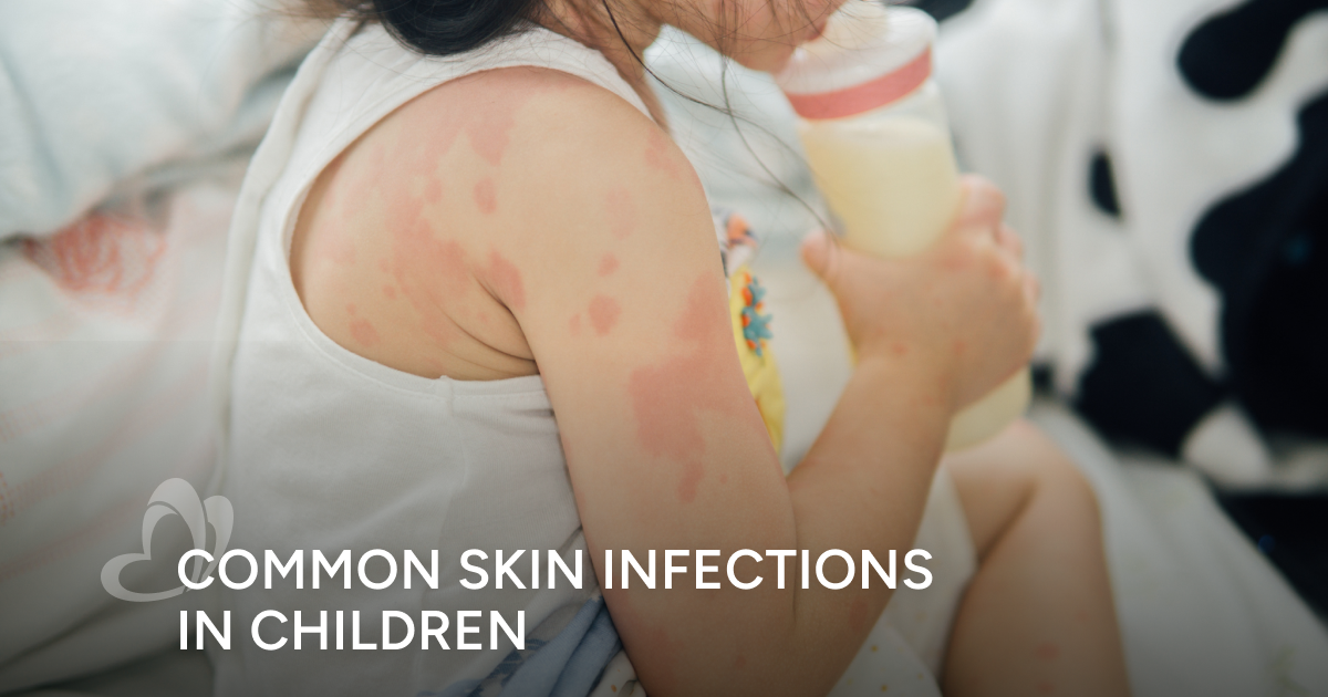 7 Most Common Skin Infections in Children | Thomson Medical