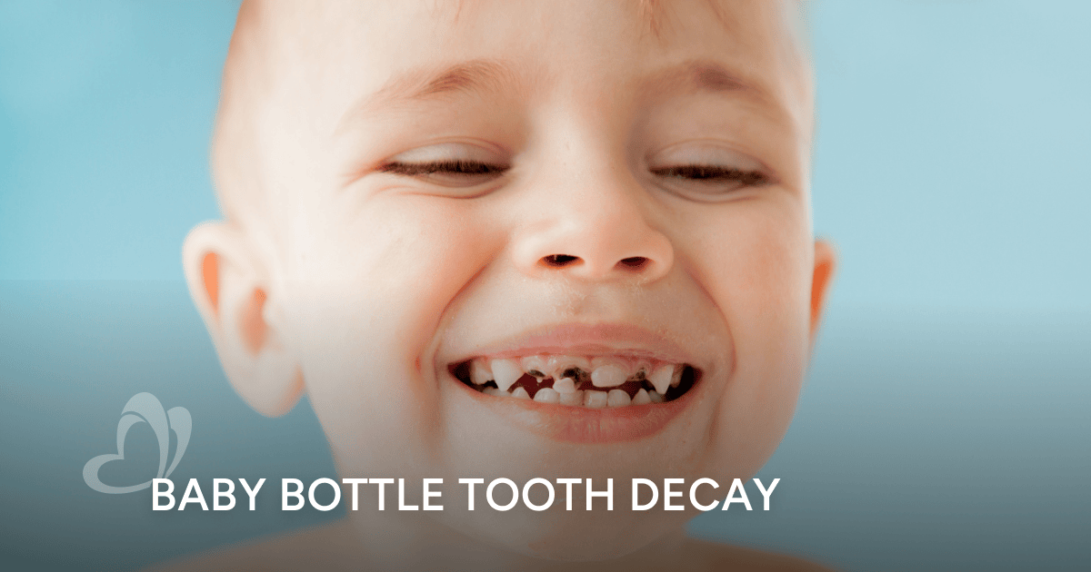 Baby Bottle Tooth Decay: Causes & Prevention Guide for Parents | Thomson Medical