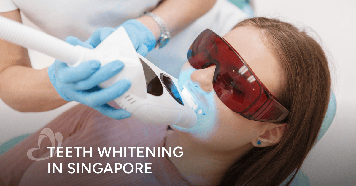 Teeth Whitening in Singapore | Thomson Medical