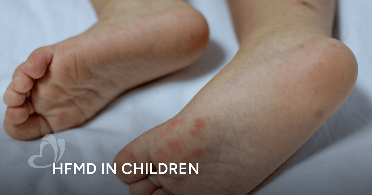 Hand, Foot, and Mouth Disease (HFMD): Home Care Tips for Parents ...