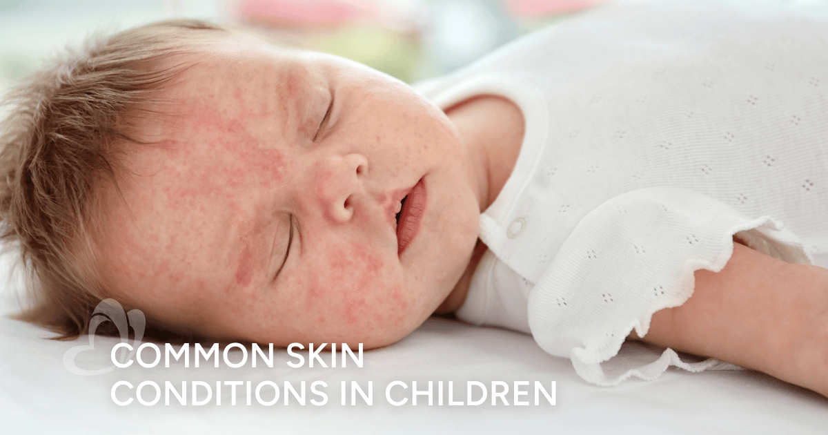 Common Skin Conditions in Children | Thomson Medical
