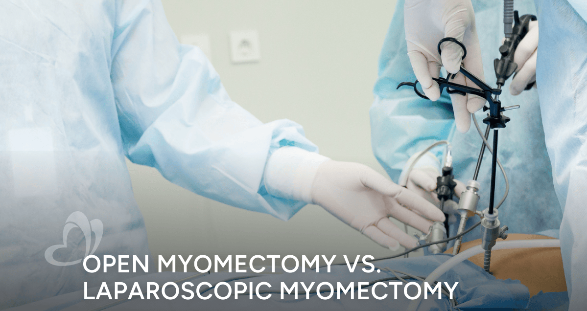 Open Myomectomy vs Laparoscopic Myomectomy: A Complete Guide | Thomson ...