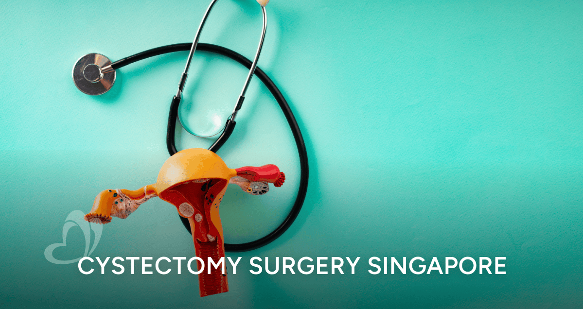 Cystectomy Surgery in Singapore: Your Complete Guide to Ovarian Cysts ...