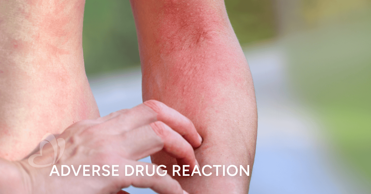 Adverse Drug Reaction | Thomson Medical
