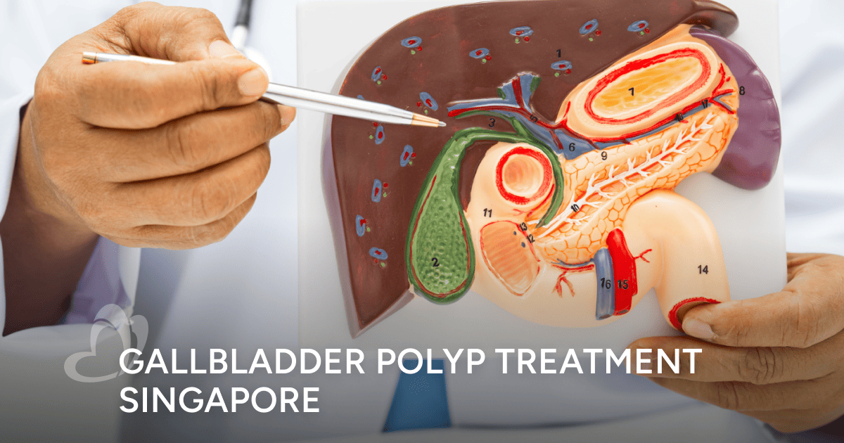 Gallbladder Polyp Treatment Singapore: What You Need to Know | Thomson ...