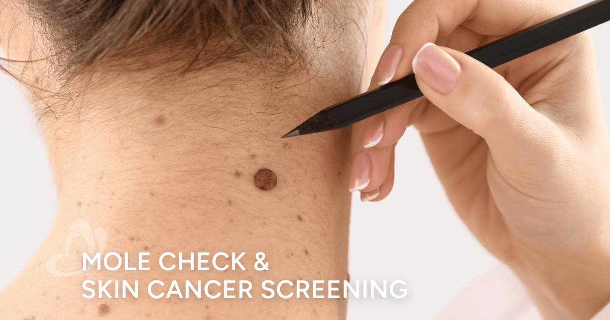 Mole Check & Skin Cancer Screening | Thomson Medical