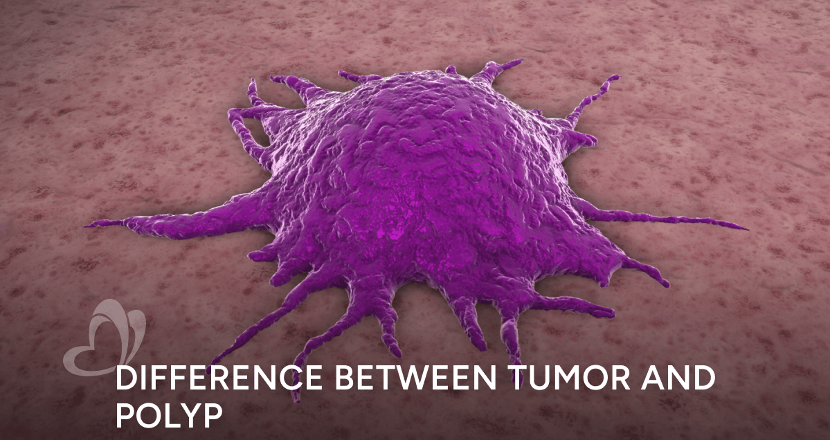Difference Between Tumor and Polyp: What You Need to Know | Thomson Medical