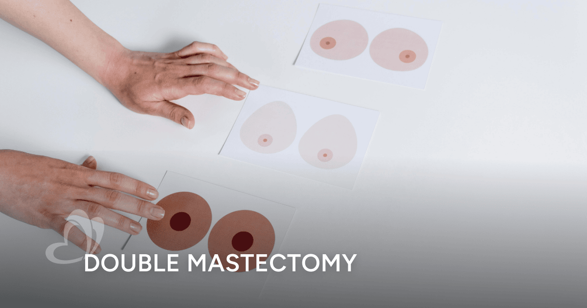 Double Mastectomy: Types, Preparation, & What To Expect | Thomson Medical