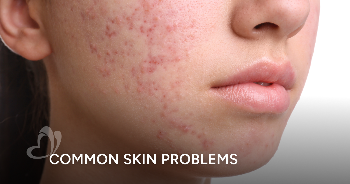3 Most Common Skin Disorders in Singapore | Thomson Medical