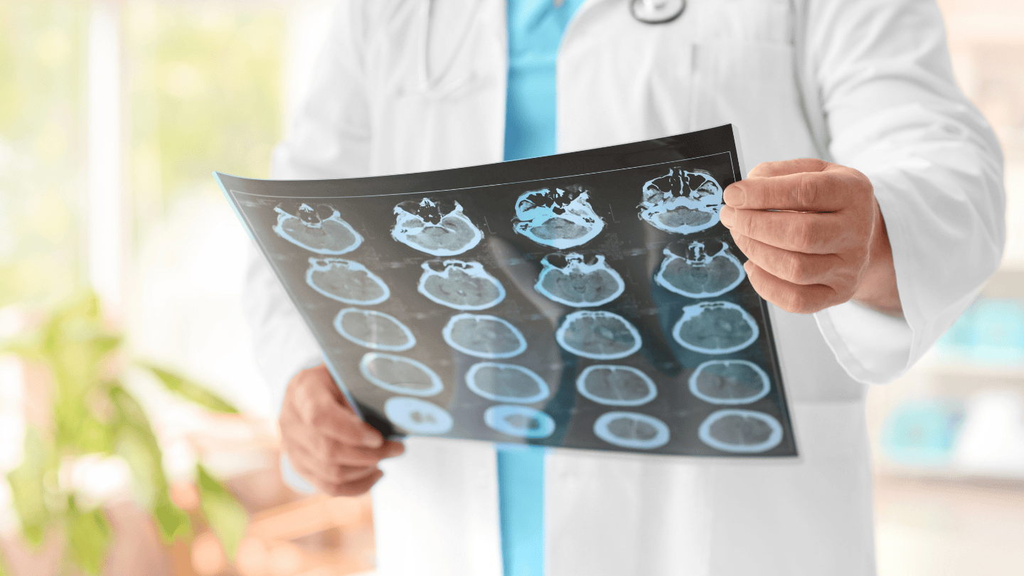 MRI Brain Scans for Dementia: Early Detection and Diagnosis | Thomson ...