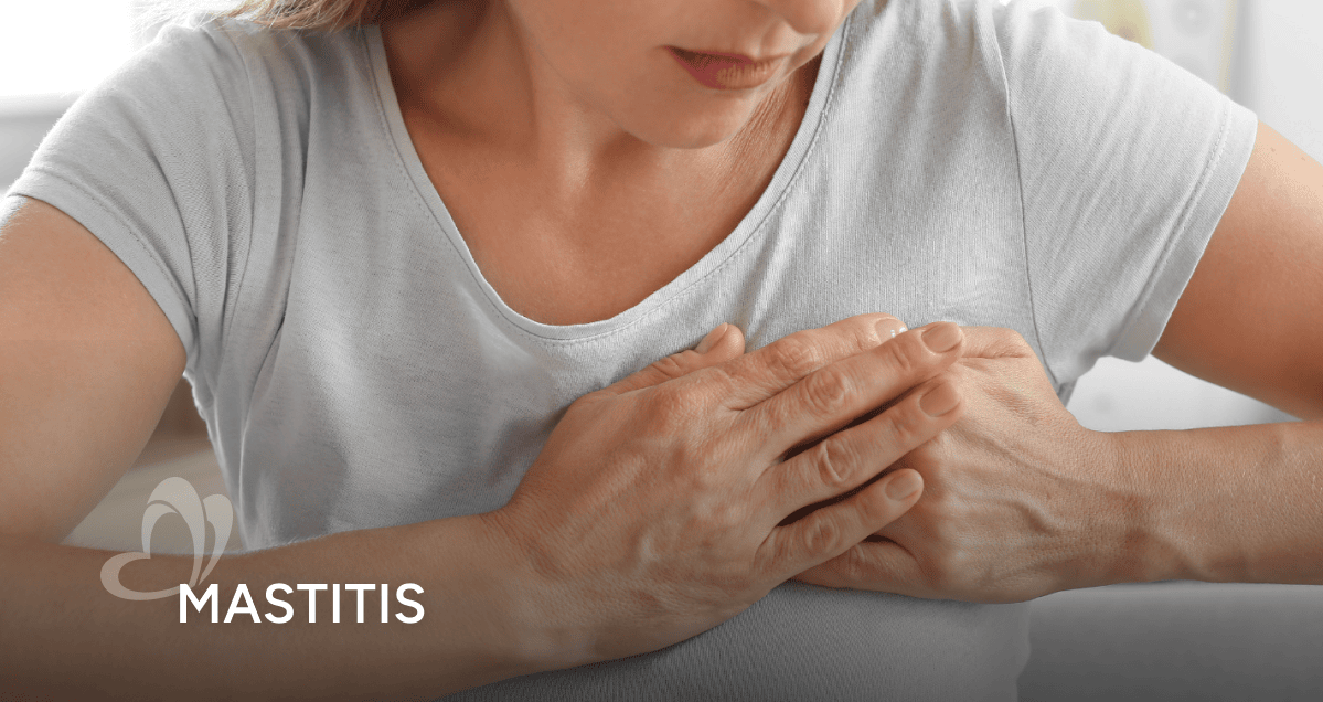 What Is Mastitis? A Complete Guide for Breastfeeding Mothers | Thomson ...