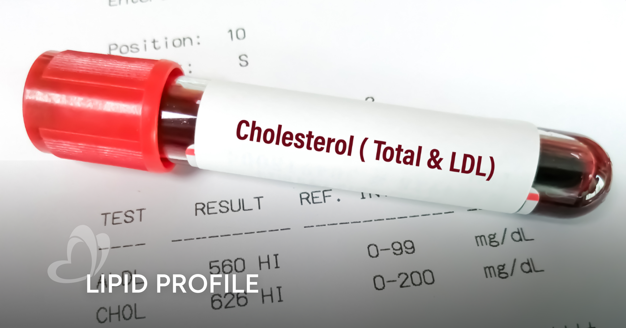 Lipid Profile Test: A Key to Heart Health | Thomson Medical