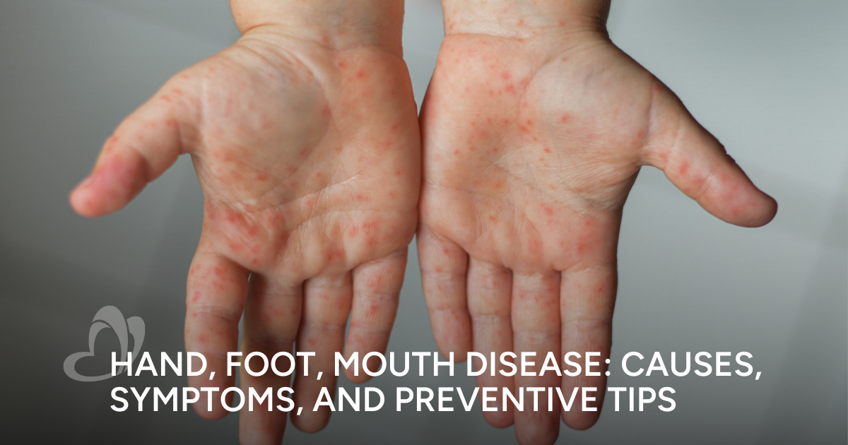 Hand Food Mouth Disease (HFMD) | Thomson Medical