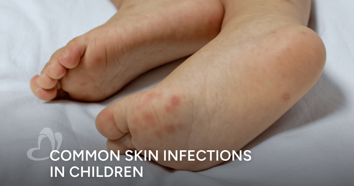 6 Common Skin Infections in Children Every Parent Should Know | Thomson ...