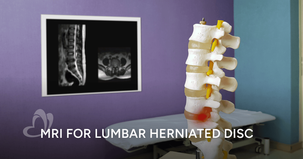 MRI for Lumbar Herniated Disc: A Guide to Diagnosis and Imaging ...