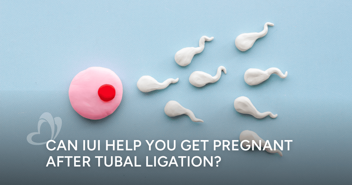 Can IUI Help You Get Pregnant After Tubal Ligation? | Thomson Medical