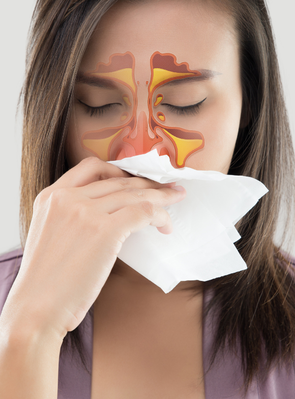 Rhinology | Thomson Medical