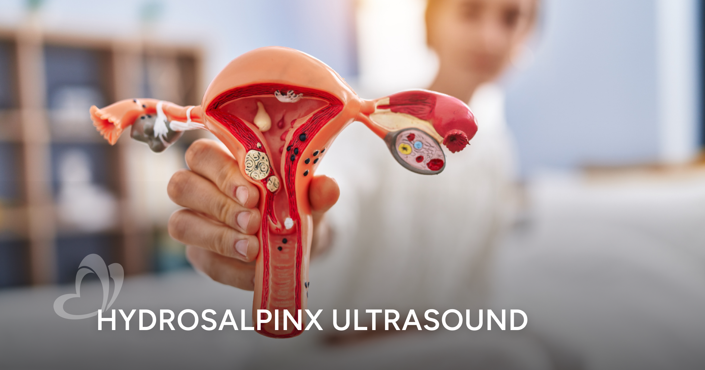 Hydrosalpinx Ultrasound: Diagnosis and Treatment | Thomson Medical