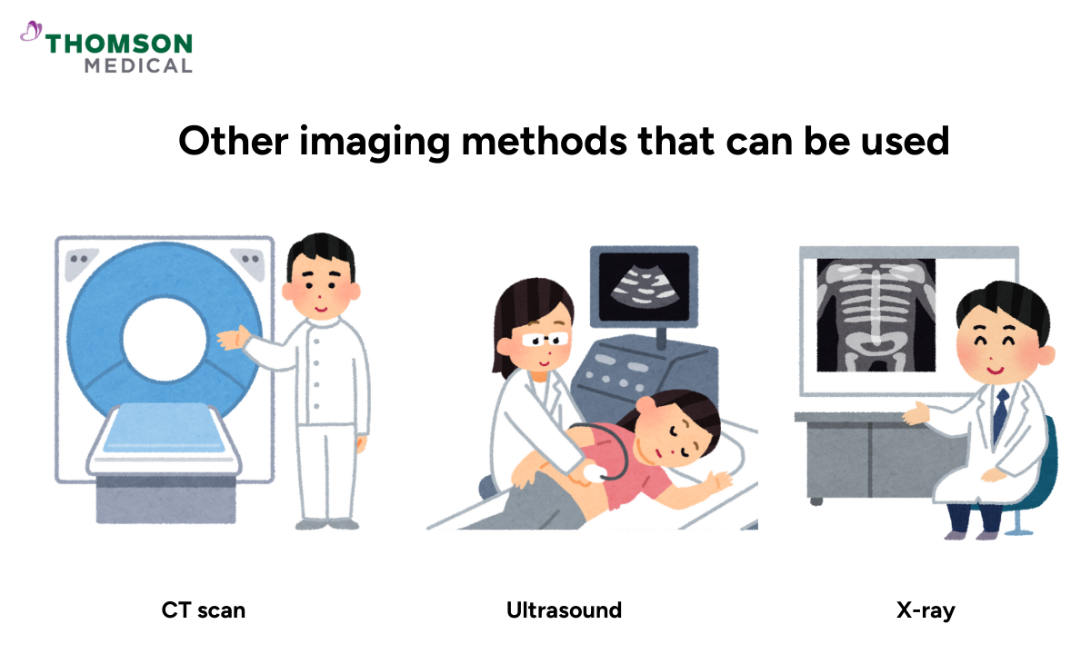 Can an MRI Detect Cervical Cancer? | Thomson Medical