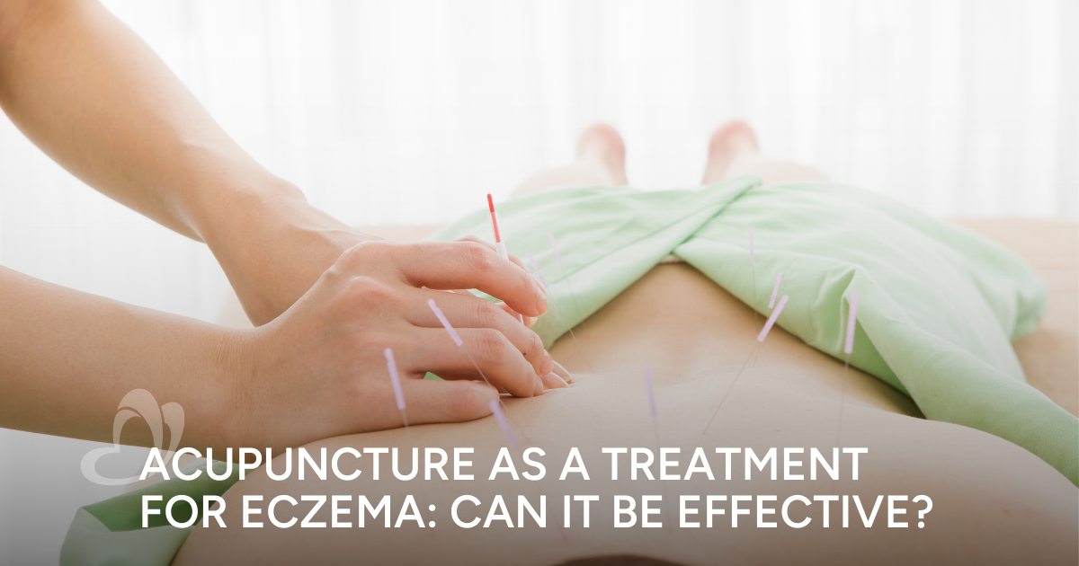 Acupuncture As A Treatment For Eczema: Can It Be Effective? | Thomson ...