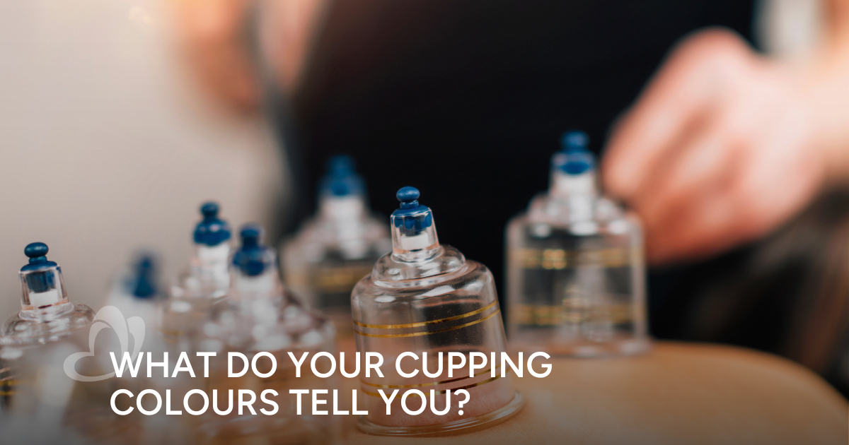 What Do Your Cupping Colours Tell You? | Thomson Medical
