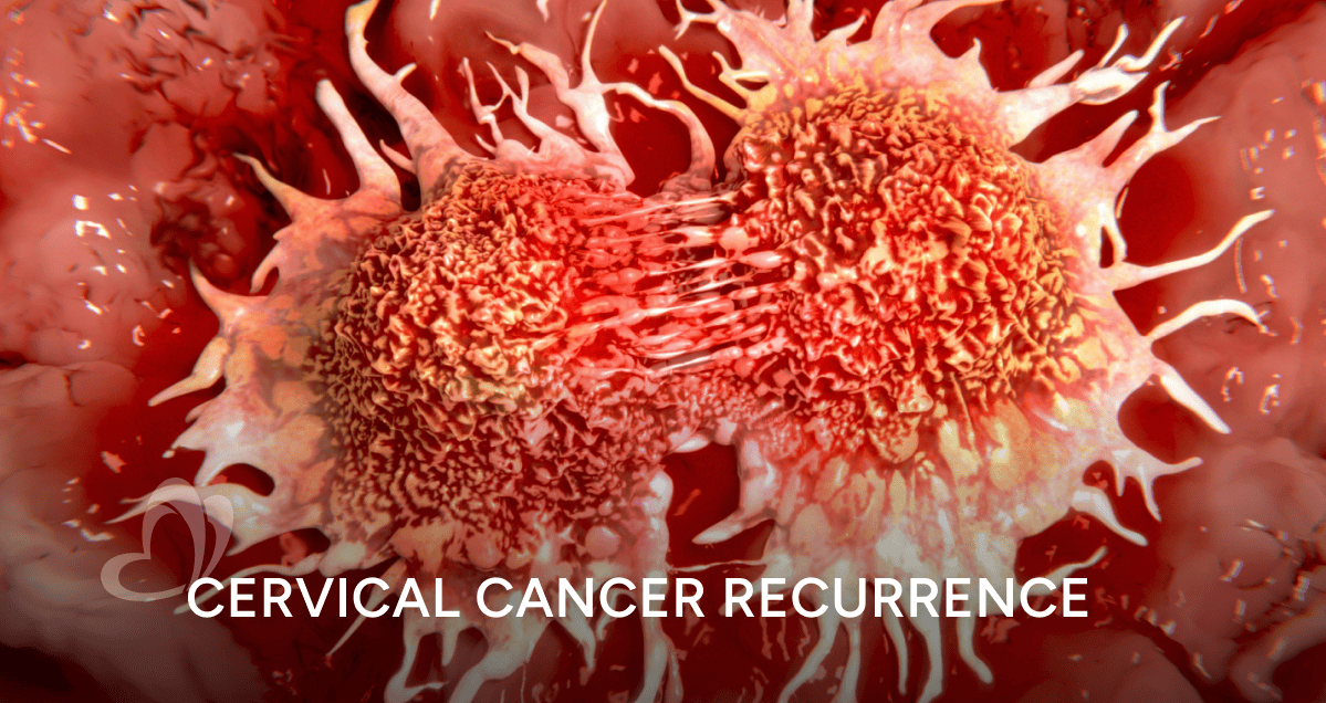 Cervical Cancer Recurrence: Risks, Symptoms, and Treatment Options ...