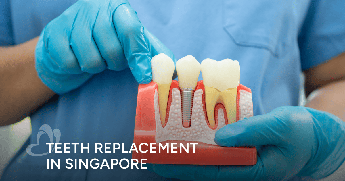 Teeth Replacement in Singapore | Thomson Medical