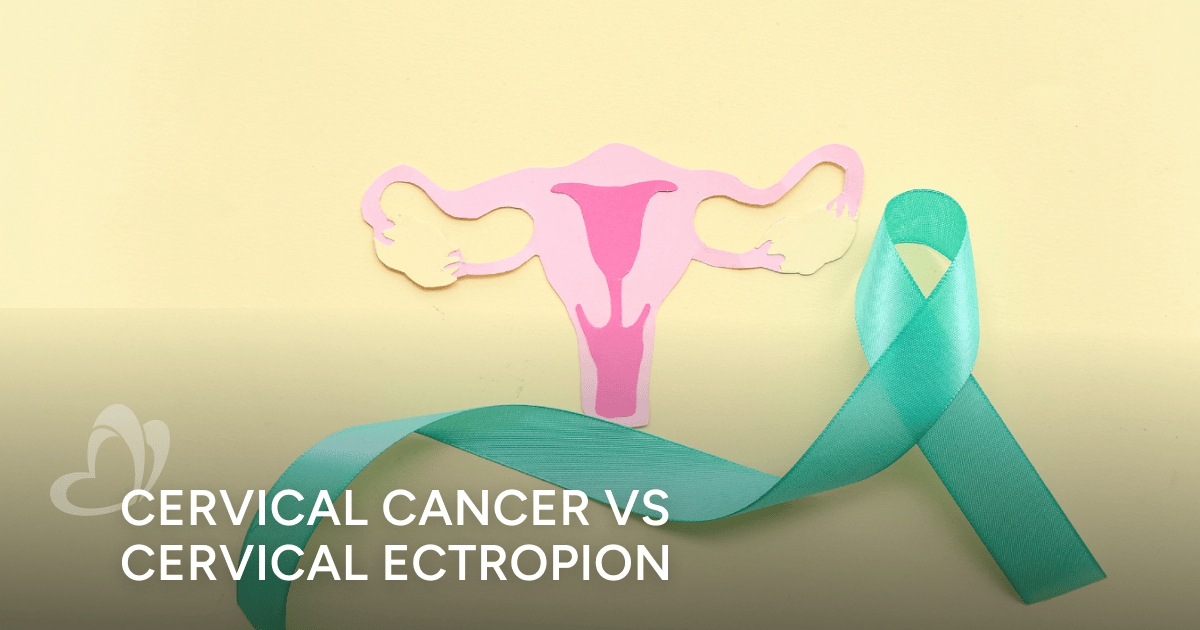 Cervical Cancer vs Cervical Ectropion: What Is The Difference ...
