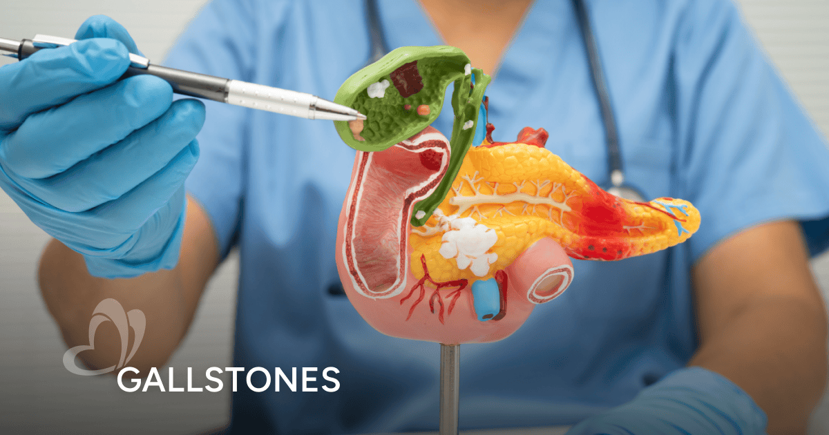 Gallstones: Causes, Symptoms, & When To See A Doctor | Thomson Medical