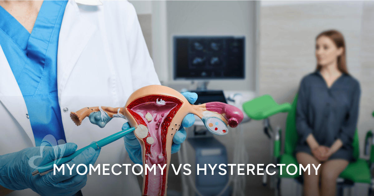 Myomectomy vs Hysterectomy: Which is Better for Fibroids? | Thomson Medical