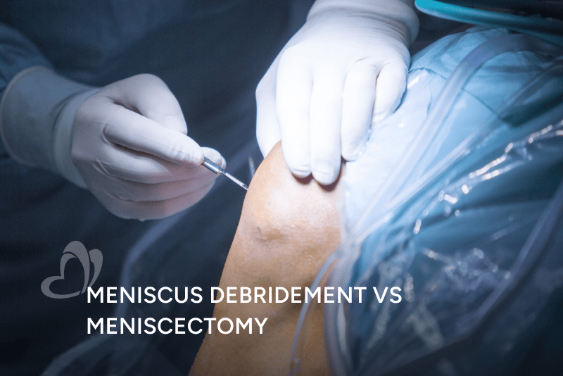 Meniscus Debridement vs Meniscectomy: Key Differences | Thomson Medical
