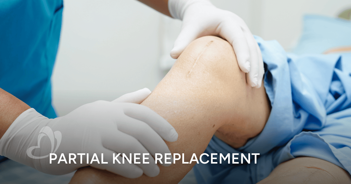 Partial Knee Replacement: Procedure and Recovery | Thomson Medical