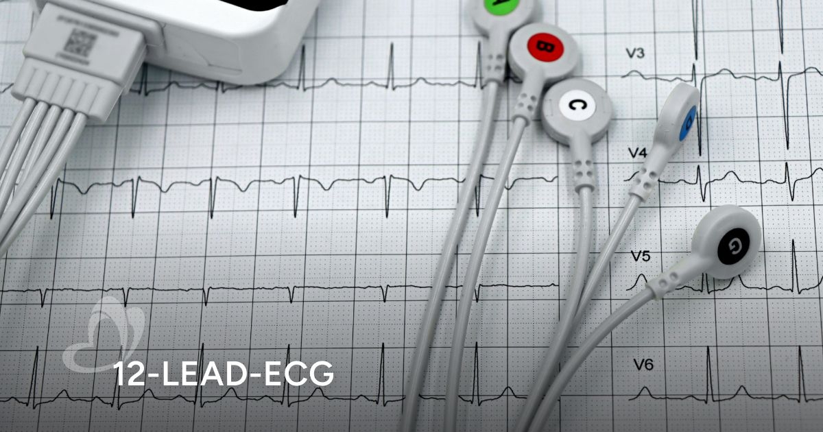 12-Lead ECG Tests: A Guide to Heart Health | Thomson Medical