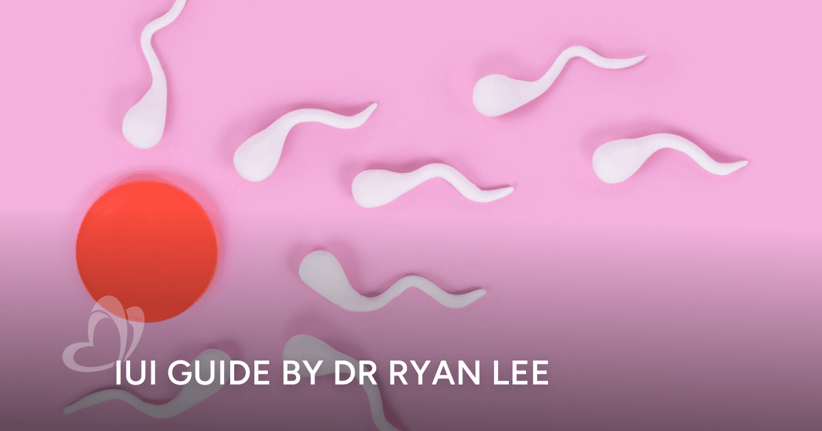 IUI (Intrauterine Insemination) Guide by Dr Ryan Lee | Thomson Medical