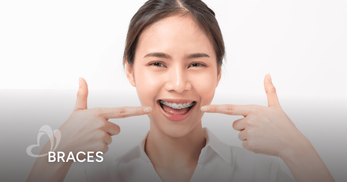 Should I Get Braces For Teeth? All You Need to Know Before Braces ...