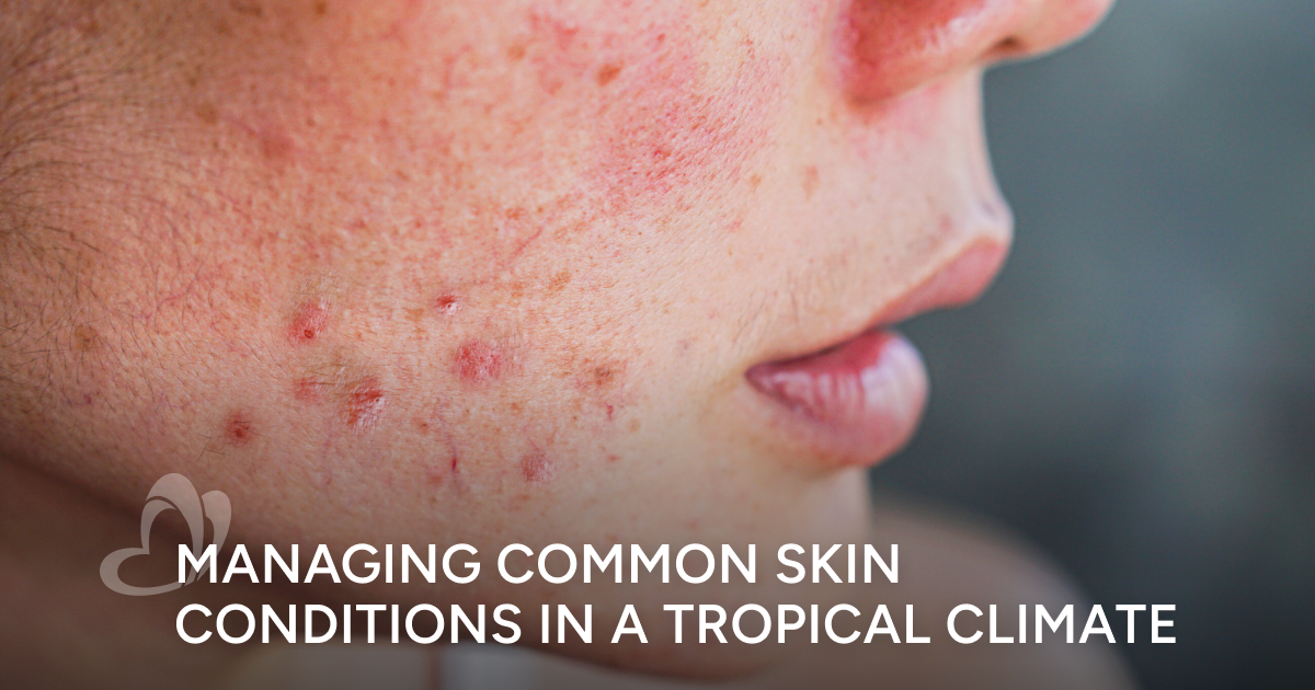 Managing Common Skin Conditions in a Tropical Climate | Thomson Medical