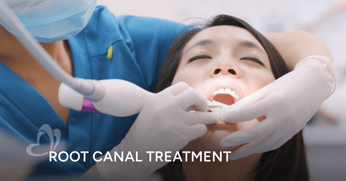 Root Canal Treatment Singapore: What to Expect | Thomson Medical