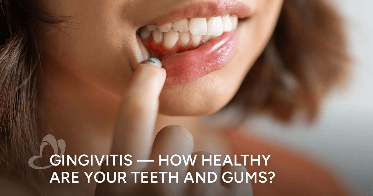 Gingivitis — How healthy are your teeth and gums? | Thomson Medical